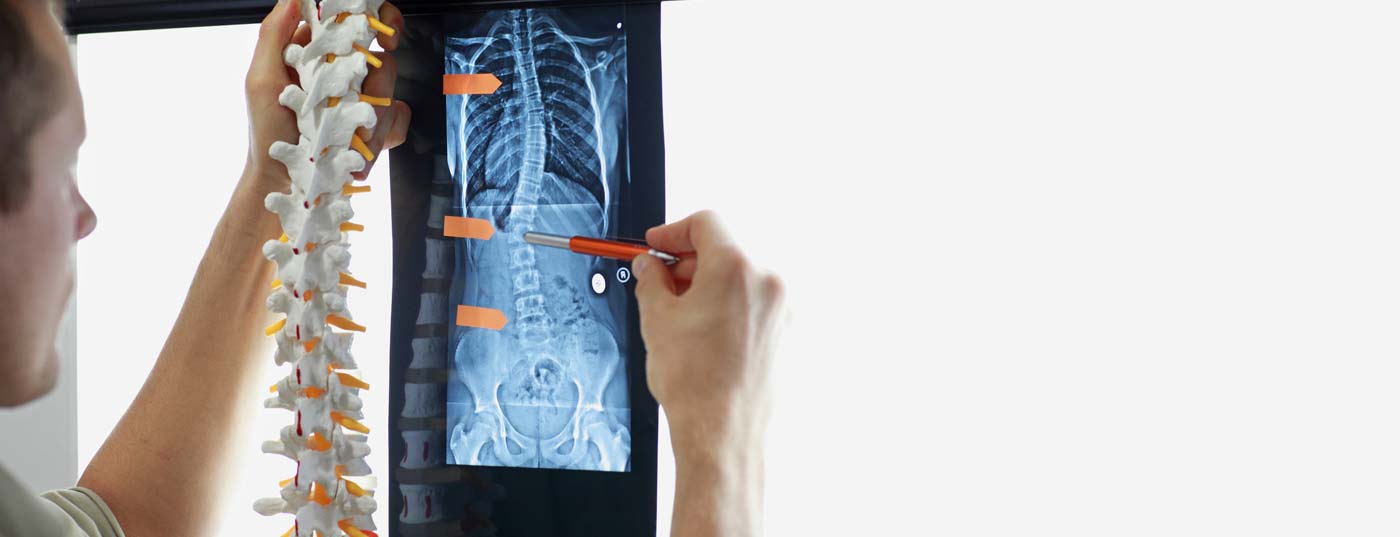 University Spine Center Wayne - Sciatic Nerve Clifton & Spinal Cord ...